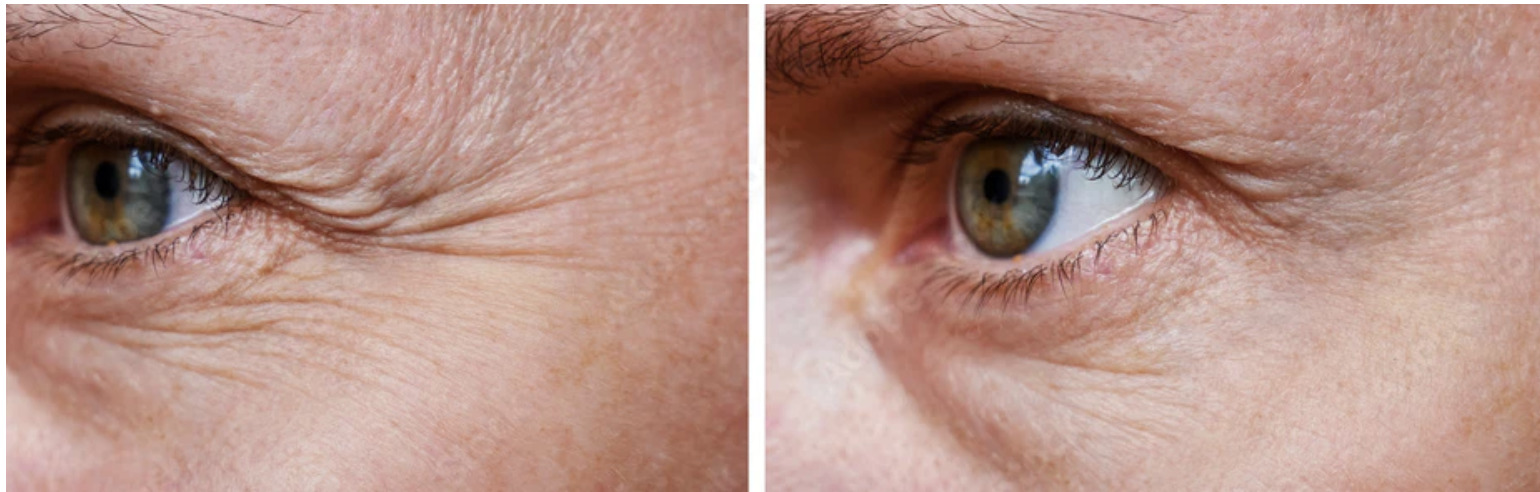 Skin rejuvenation using stem cells in the best clinics - MedTour